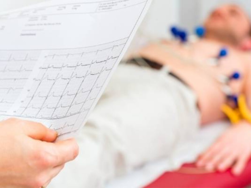 Test Your Knowledge: Comprehensive EKG Practice Exam ...